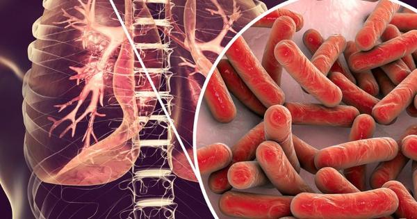 OMS divulga relatório global sobre tuberculose - Academia Médica